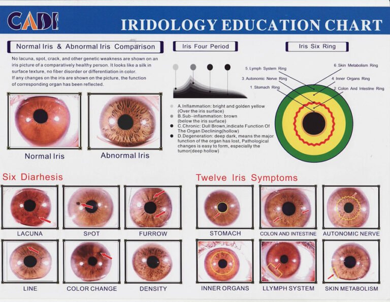 Mapa Del Iris En Iridología: Guía Autoritativa - Iriscopio, Iriscopio ...