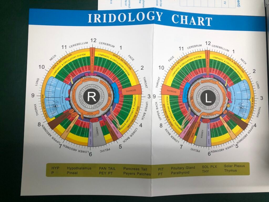 Mapa Iridológico: Perspectivas Integrales En El Análisis Del Iris ...