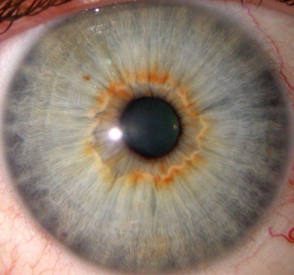 El Color Del Iris En Iridología: Significado Y Relación Con La Salud ...